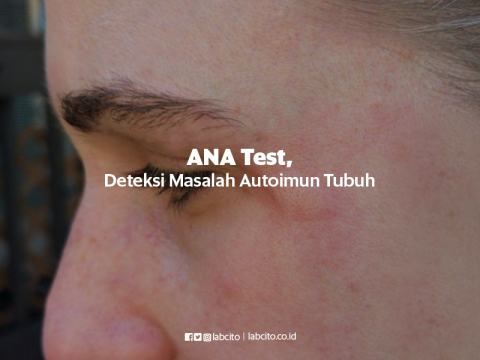 ANA Test (Anti Nuclear Antibody), Deteksi Masalah Autoimun Tubuh